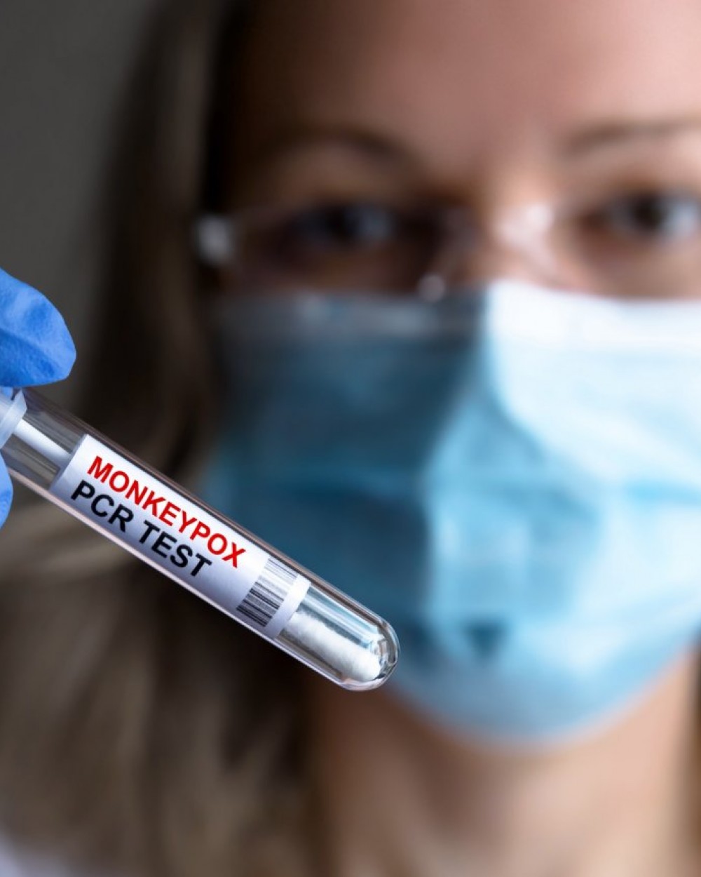 Monkeypox Test