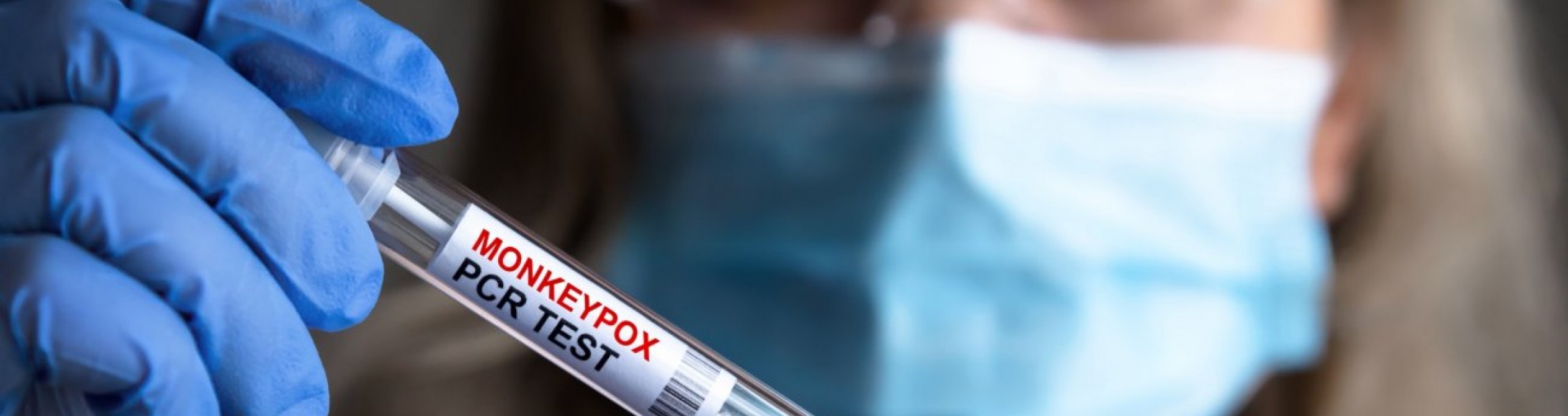 Monkeypox Test